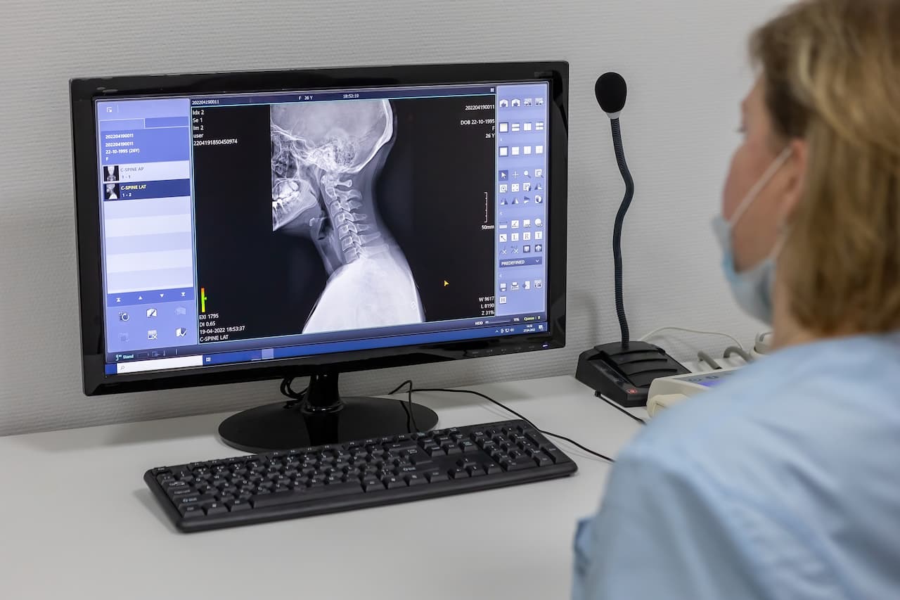 7 Benefícios Do Rx Digital Que Otimizam O Atendimento Ao Paciente ...